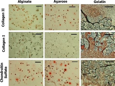 Immunohistochemistry Of Cartilage Constructs Engineered With Human Download Scientific Diagram