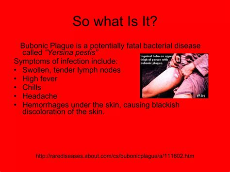 Sylvatic Plague Ppt Infectious Diseases Diseases And Conditions