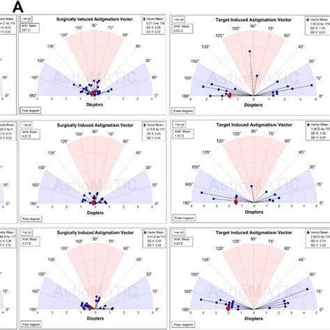 Preoperative And Postoperative Values Of Iop Nct Iop Gat Iopg And
