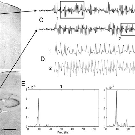 Photomicrographs A And B Of Nissl Stained Thionin Frontal Sections