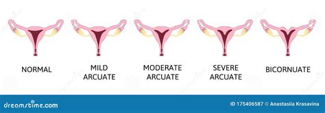The Shape Of The Uterus The Female Reproductive Organ Stock Illustration Illustration Of