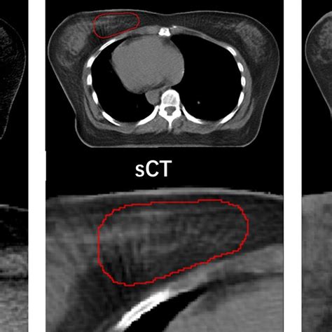 Comparison Of Soft Tissue From Cbct Sct And Pct Images With Same Download Scientific Diagram