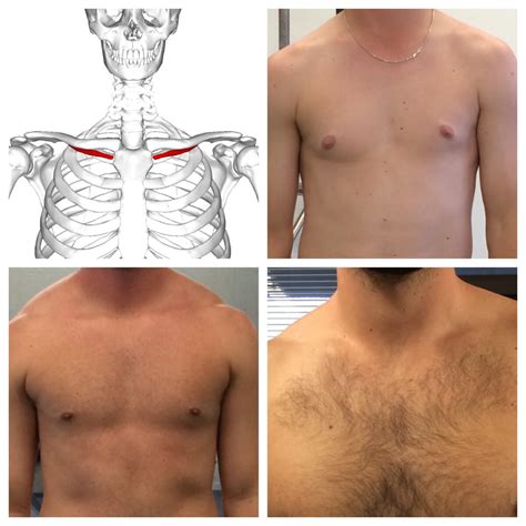 Making Sense Of Subclavius