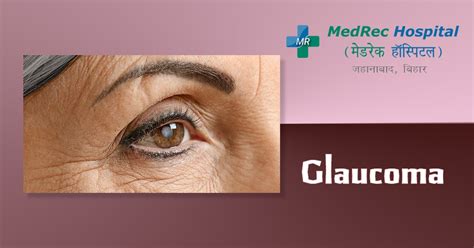Glaucoma Guide To Diagnosis Treatment And Prevention