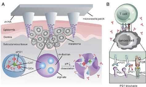 4 A Schematic Presentation Of The Microneedle Mn Patch Assisted