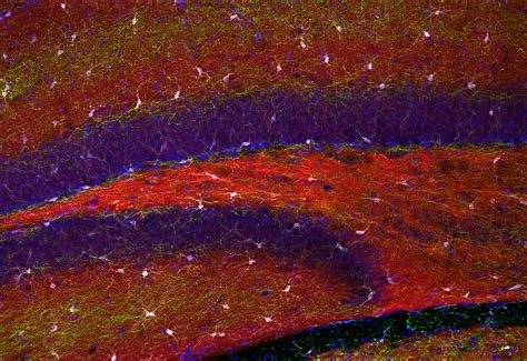 Synaptic Systems Munc13 1