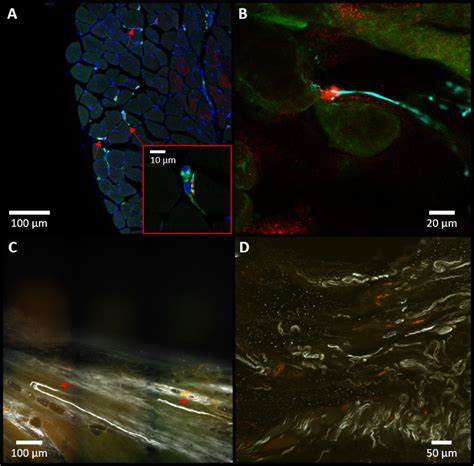 Video Fabrication Of The Composite Regenerative Peripheral Nerve