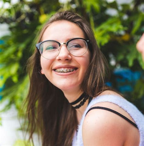 Pin By Michael Bierbaum On Orthodontic Appliances Glasses Fashion