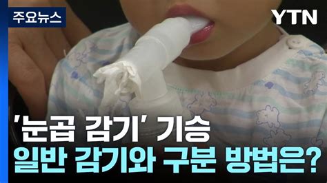 기승하는 눈곱 감기 일반 감기와 구분하는 방법은 Y녹취록 Ytn Youtube