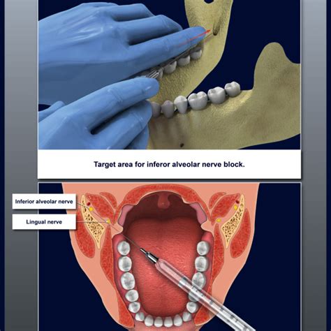 Medical Legal Exhibits Legal Animations And Trial Graphics