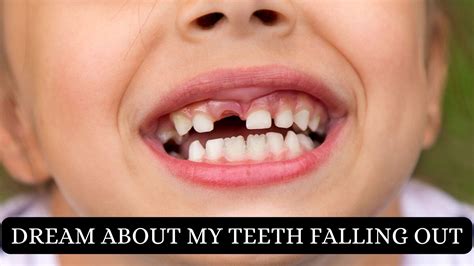 Dream About My Teeth Falling Out What Does It Mean