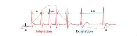 Respiratory Sinus Arrhythmia Rsa The Heart Rate Increases During