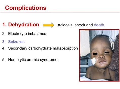 Acute Pediatric Gastroenteritis Pptx Digestive Disorders Diseases