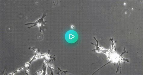 Fetal Neurons Forming Connections In Vitro  On Imgur