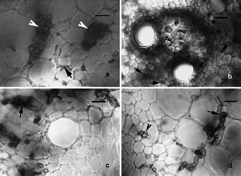 Photomicrographs Of Distribution Of Hyphae Of U Esculenta In The Culm