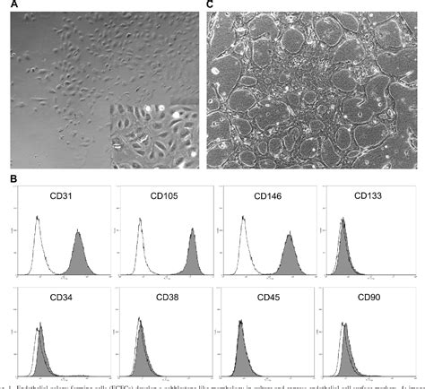 Figure 1 From Hyperoxia Disrupts Vascular Endothelial Growth Factor