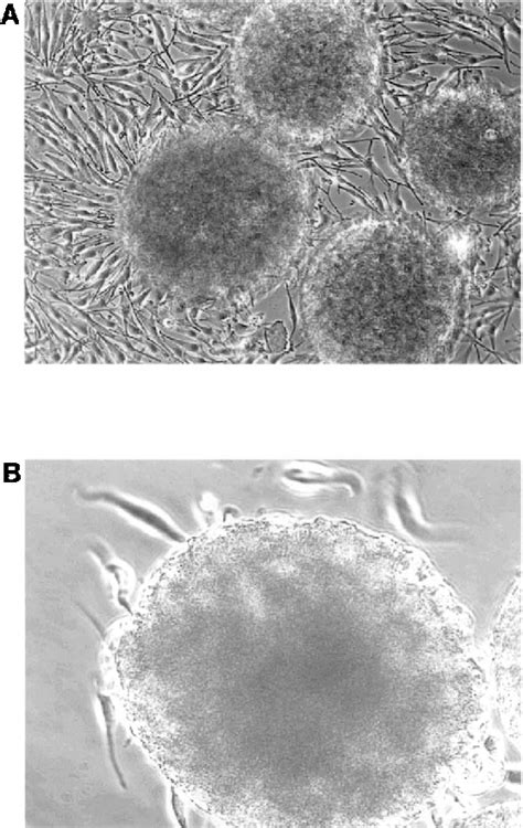 Figure 2 From Bioreactor Microcarrier Cell Culture System Bio Mccs