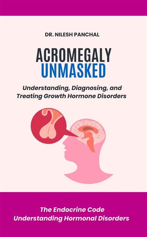 The Endocrine Code Understanding Hormonal Disorders 1 Acromegaly