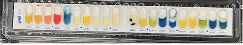Identify Api Strip Rmicrobiology Identify Api Strip Rmicrobiology