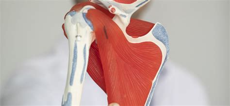 Proteza Umar Indicatii Recuperare And Pret Artoplastie Ortopedicum