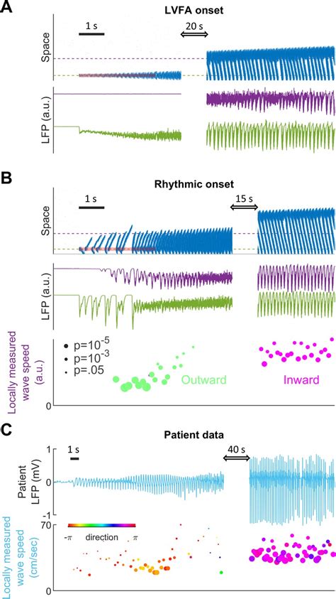 Figures And Data In A Model For Focal Seizure Onset Propagation