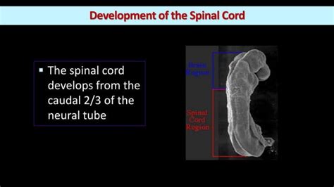 Embryology And Development Of Spinal Dysraphism And Tethered Spinal