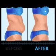Plastic Surgery Animation S Tenor