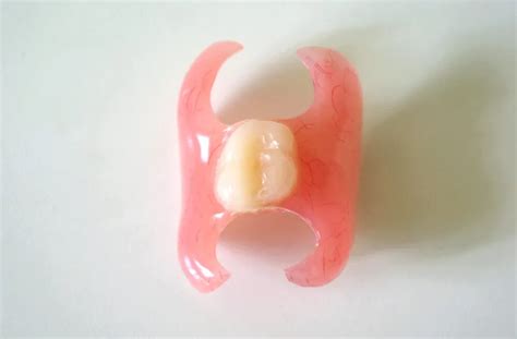 Removable Partial Denture For One Tooth What Are The Best Dentures To