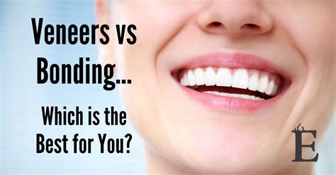 Veneers Vs Bonding Dr E Dentistry