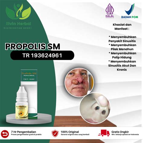 Obat Sinusitis Pilek Menahun Alergi Hidung Gurah Hidung Polip Hidung
