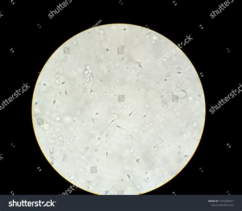 Testicular Sperm Extraction Over 1 Royalty Free Licensable Stock