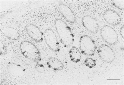Gastrointestinal Hormones W3schools