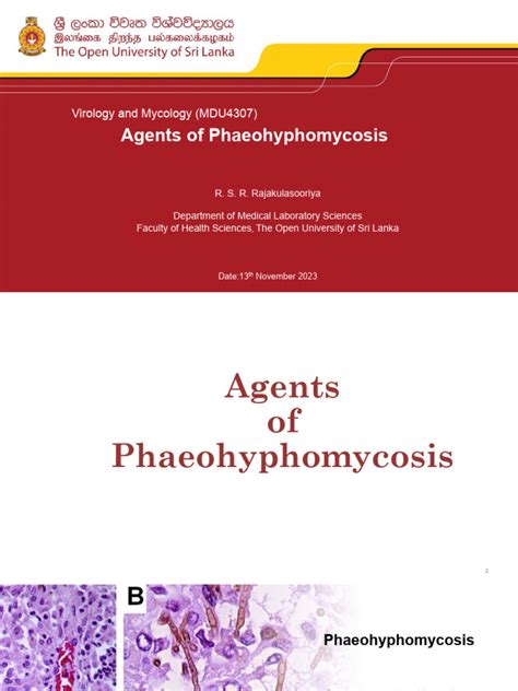 D4 Phaeohyphomycosis Pdf Microbiology Mycology