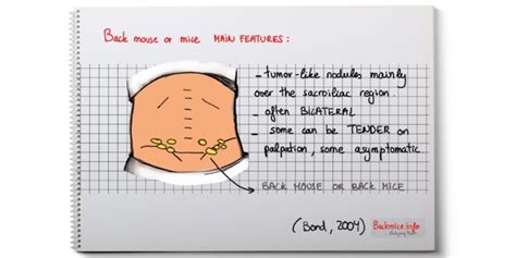 2004 Bond Treatment Of The Back Mouse