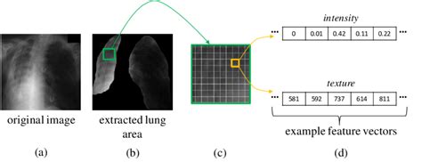 Feature Extraction Process A Chest Radiographic Image B The Lung