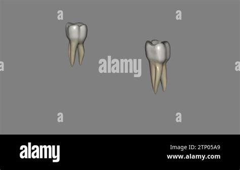 The Mandibular Second Molar Resembles The Mandibular First Permanent Molar Except That The