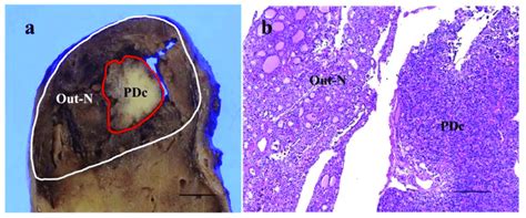 Representative Image Of Cut Surface Of Thyroid Follicular Patterned