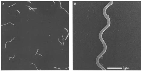Borrelia Burgdorferi Microscope 20 B Burgdorferi Royalty Free Images