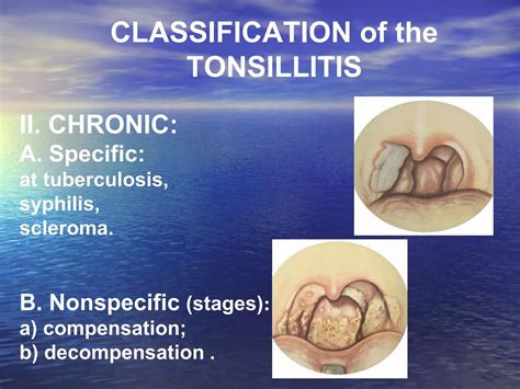 Anatomy And Physiology Of Pharynx Tonsillitis Ppt