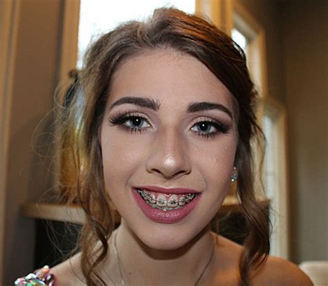 Pin By Joseph Bayer On My Saves Cute Braces Braces Girls