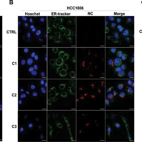 The Nanoclusters Accumulate Mainly In Cell Lysosomes Colocalization