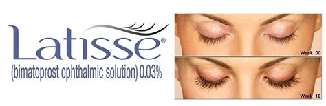 Latisse Before And After Side Effects
