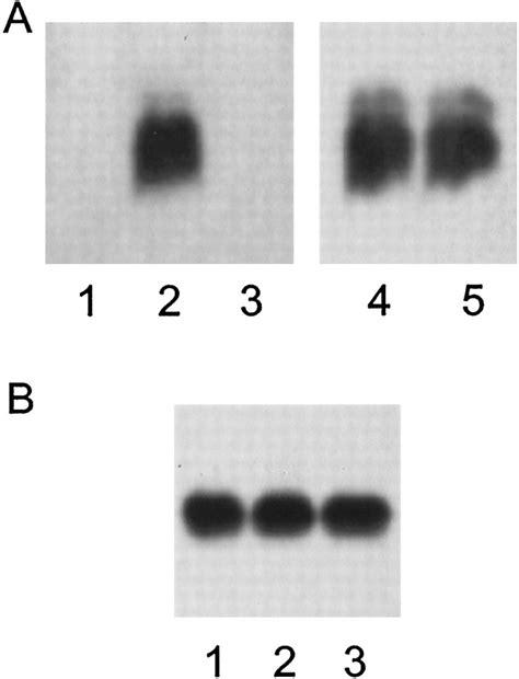 Calmodulin Binding Peptide Pep 19 Modulates Activation Of Calmodulin Kinase Ii In Situ Pmc