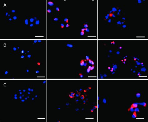 Small Medium And Large Sized Cell Clusters Of The Control And Its