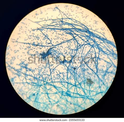 Mentagrofitas De Trichophyton T Mentagrofitas Bajo Foto De Stock 2355655133 Shutterstock