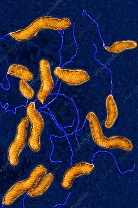Helicobacter Pylori Light Micrograph Stock Image C0584658