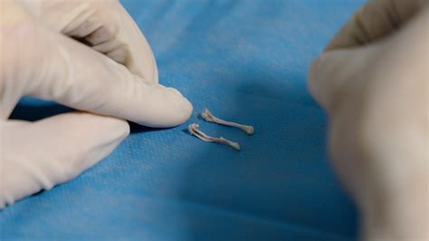 Trabecular Bone Microarchitecture Evaluation In An Osteoporosis Mouse Model Protocol