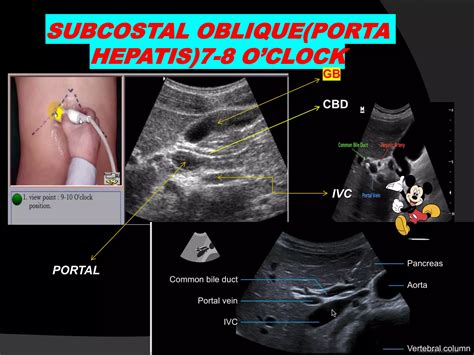 How To Do Liver Ultrasound Pdf