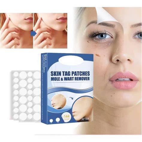 Skin Tag Removerpatch Détiquettes De Peauverrue Patchpatch Anti Verruesinvisibles