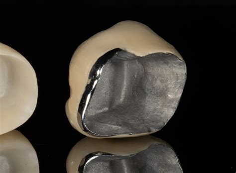 Crowns And Bridges The Cosmetic Dental Clinic